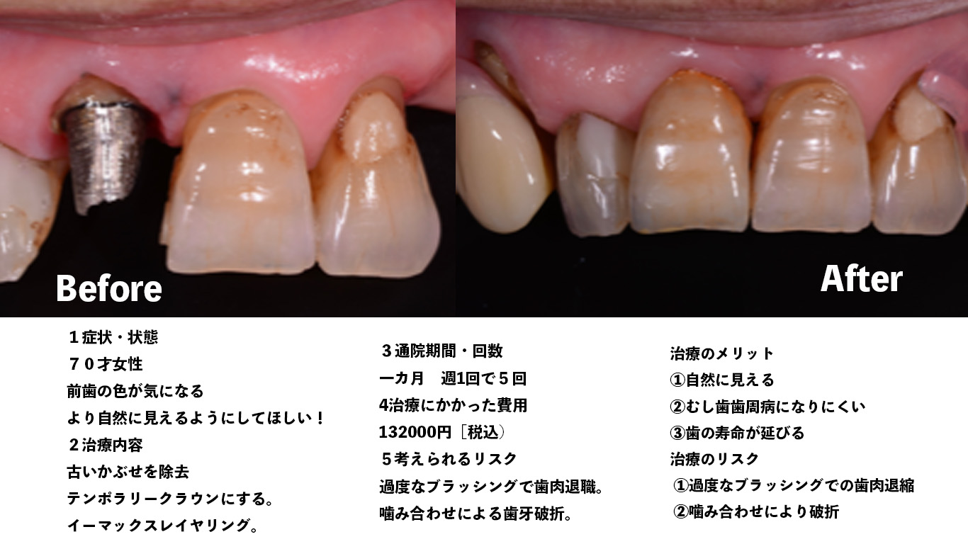 症例事例 柳沢歯科クリニック